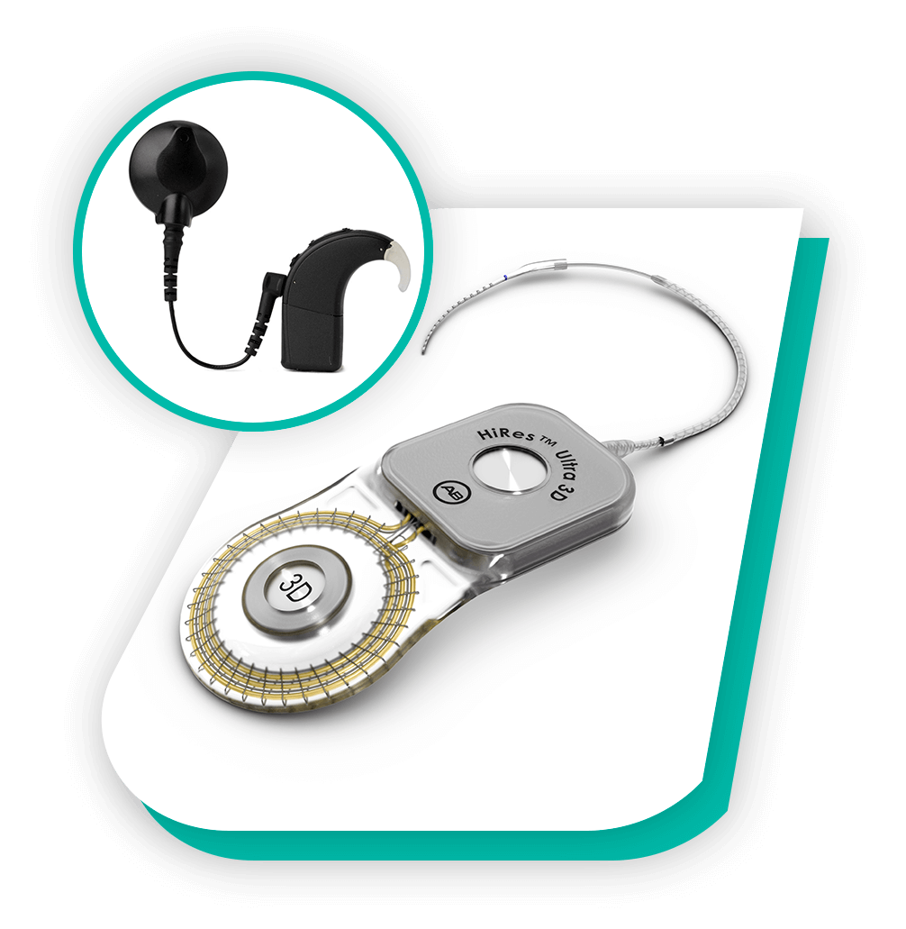 Implante Coclear - Inova Aparelhos Auditivos